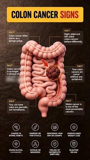 Learn key colon cancer signs and symptoms through a clear medical animation for awareness.
