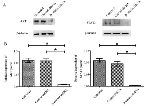 β Catenin Knockdown Inhibits Pituitary Adenoma Cell Proliferation And