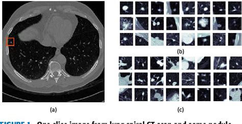 Figure 1 From Multi Resolution Cnn And Knowledge Transfer For Candidate