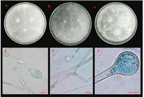 Isolation And Identification Of Fungi With Glucoamylase Activity From