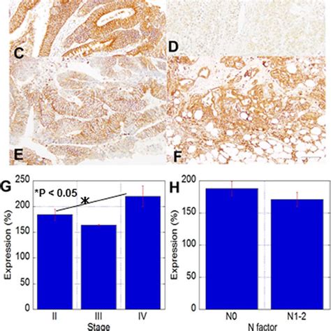 Cldn4 Expression And Correlations With Clinicopathological Parameters