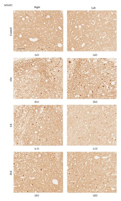 Representative Photomicrographs Showing C Fos Immunoreactivity In The