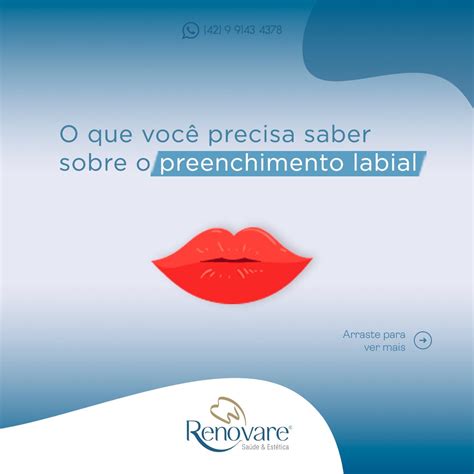 Quer Dar Volume E Definir O Contorno Dos Seus Lábios O Preenchimento