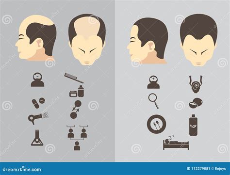 Male Hair Loss Stages Set Man Before And After Hair Treatment And Hair