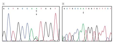Sequence Analysis Of The Region Of The Fibrillin 1 Gene Fbn1