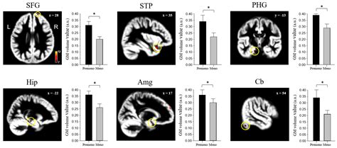 Jcm Free Full Text Altered Sexual Response Related Functional