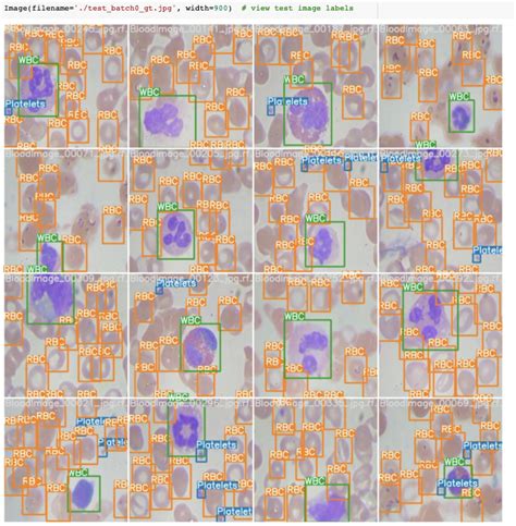 how to train yolov5 on a custom dataset