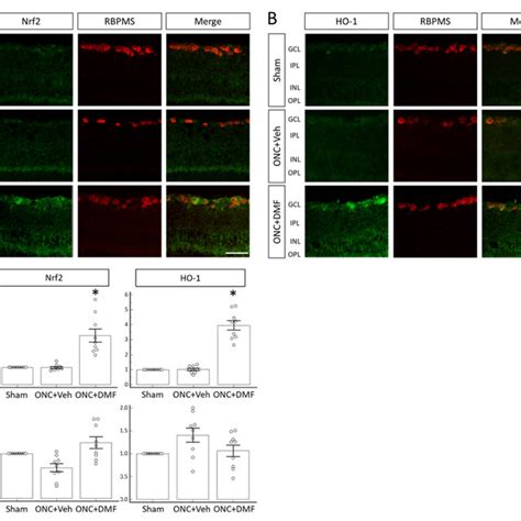 Nf E2 Related Factor 2 Nrf2 And Heme Oxygenase 1 Ho 1 Expression In