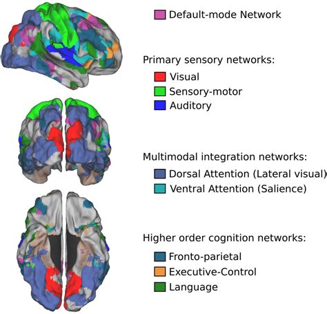 Hyperconnectivity Of The Default Mode Network In Multiorgan Dysfunction