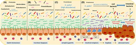 Schematic Model Representation Of The Gastric Microbial And Mucosal