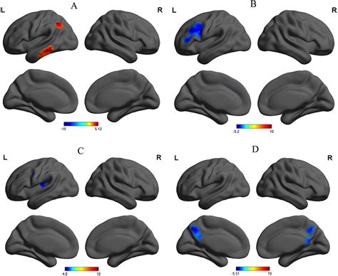Seed Based Functional Connectivity Differences For Each Region Of