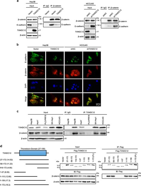 Txndc12 Promotes Emt And Metastasis Of Hepatocellular Carcinoma Cells