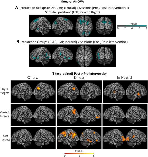 A Brief Exposure To Leftward Prismatic Adaptation Enhances The