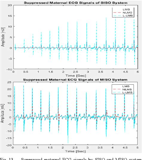 Figure 13 From Non Invasive Extraction Of Fetal And Maternal Ecg
