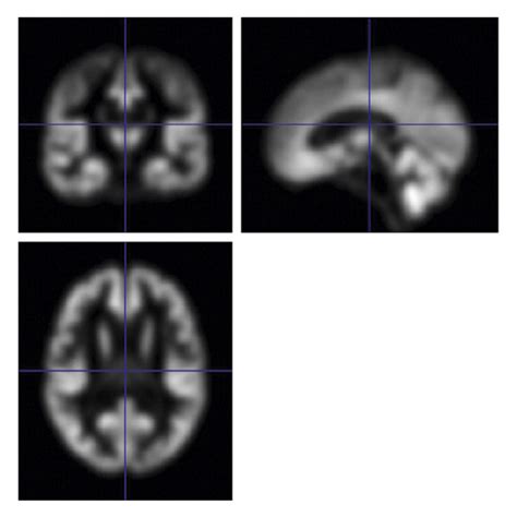 Preprocessing Results Of A Smri Data And B Fmri Data Download