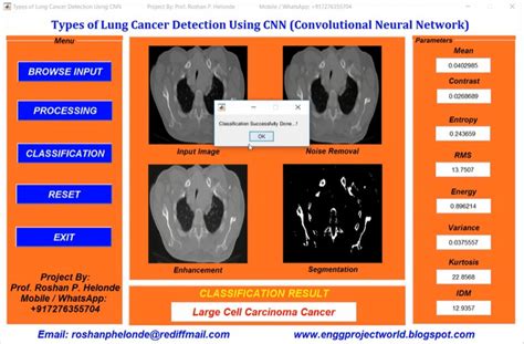 Types Of Lung Cancer Detection Using Convolutional Neural Network Cnn