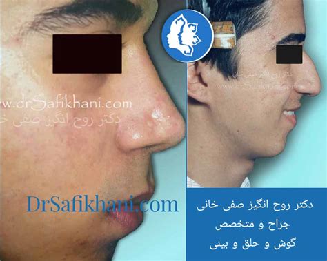 گالری دکتر روح انگیز صفی خانی جراح و متخصص گوش و حلق و بینی جراح