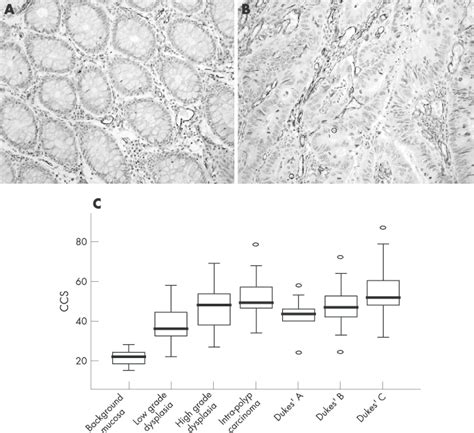 Microvessel Density Across The Adenoma Carcinoma Sequence