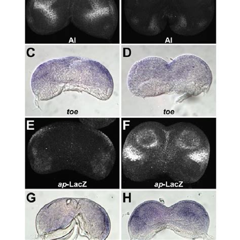 Sex Differential Expression Of Genes Encoding Transcription Factors