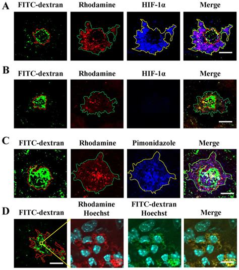 Localization Of Hif 1α And Poh Rhodamine In Rpe Choroid Sclera Flat