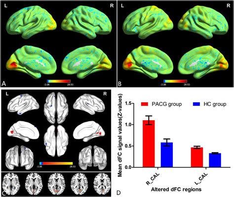 Frontiers Altered Dynamic Functional Connectivity In The Primary
