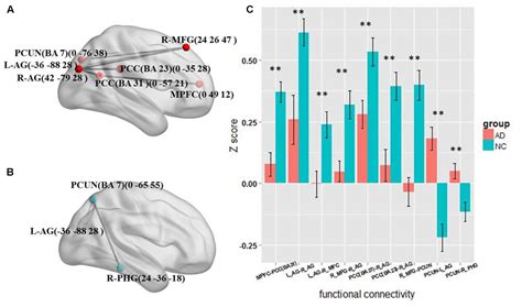 Frontiers Frequency Dependent Altered Functional Connections Of