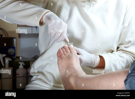 Do Podiatrists Cut Toenails