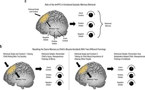 Dorsomedial Prefrontal Cortex
