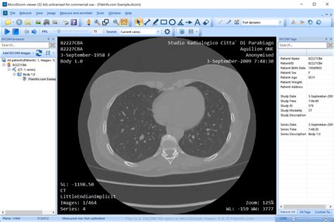 sample dicom images download oracionparaunapersonaquevanaoperar