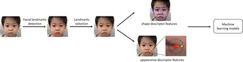 Frontiers Automated Facial Recognition For Noonan Syndrome Using