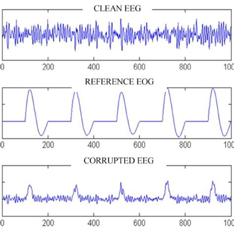 Sample Embedding Of Eeg Signal With Eog Artifact Adapted From
