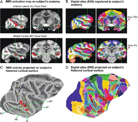 Mapping Fmri Results Onto The Digital Atlas A Fmri Activation From A