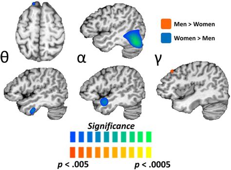Spectrally Specific Interactions Between Age And Sex In Oscillatory