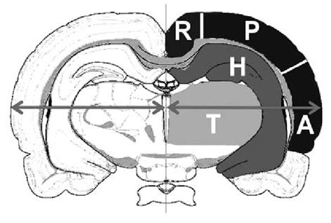 Regions Of Interest Selected For Analysis Were The Retrosplenial Cortex