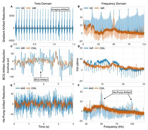 Frontiers Evaluation And Comparison Of Most Prevalent Artifact