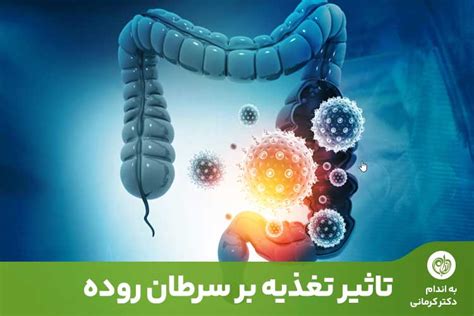 ارتباط سرطان روده و تغذیه رژیم غذایی برای پیشگیری و درمان سرطان روده