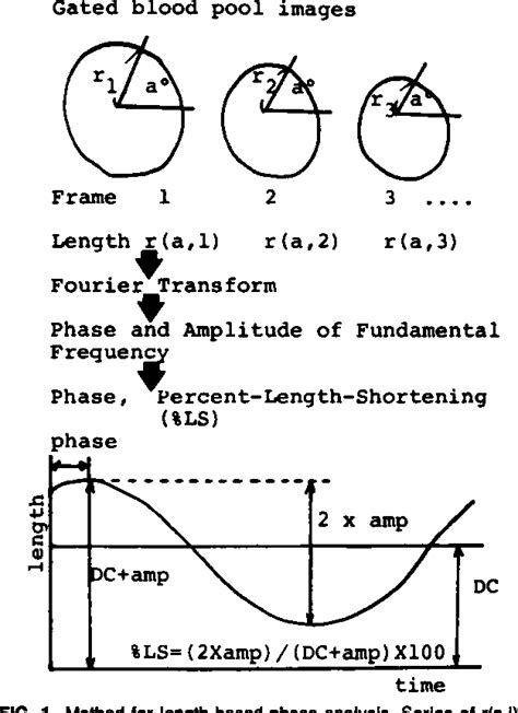 Figure 1 From Quantification Of Segmental Wall Motion By Length Based