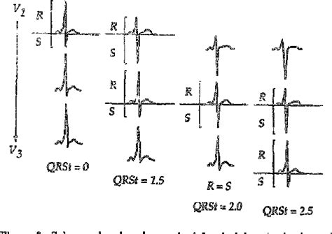 Figure 2 From New Algorithm For The Localization Of Accessory