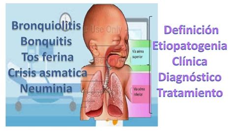 Infecciones Respiratorias Bajas Pediatria