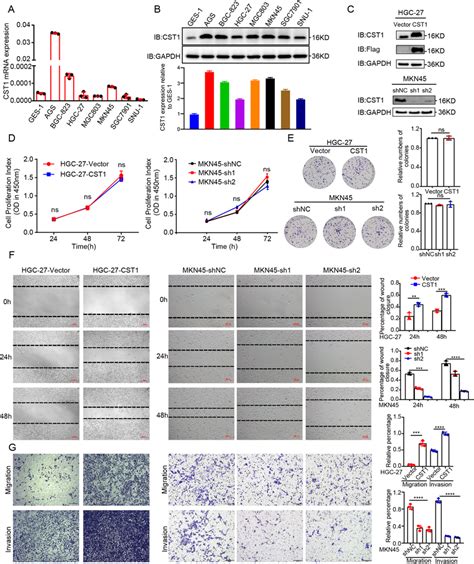 Cst1 Promotes Gc Cell Metastasis But Not Proliferation In Vitro A B