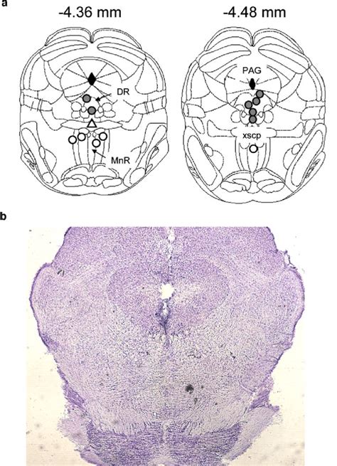 Raphe Nucleus Cross Section
