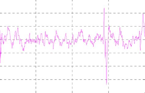 Shows Typical 2000 Samples Epileptic And Normal Eeg Signals From A