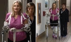 Michigan Woman Who Lost Hands And Legs To Septic Shock Speaks Out