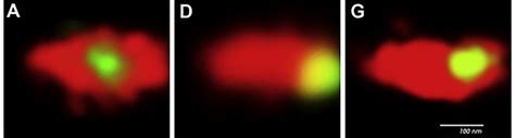 Virology Applications With Single Molecule Localization Microscopy Bruker