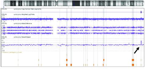 Snp Chromosome Microarray Plot Of Chromosome 7 Demonstrating Two