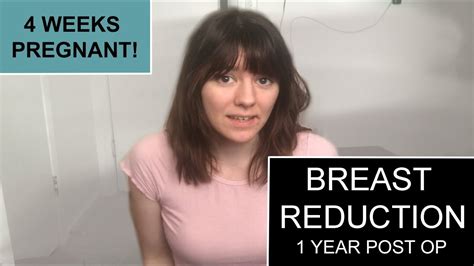 Breast Reduction 1 Year Post Op Week 4 Pregnancy Update 34ddd To