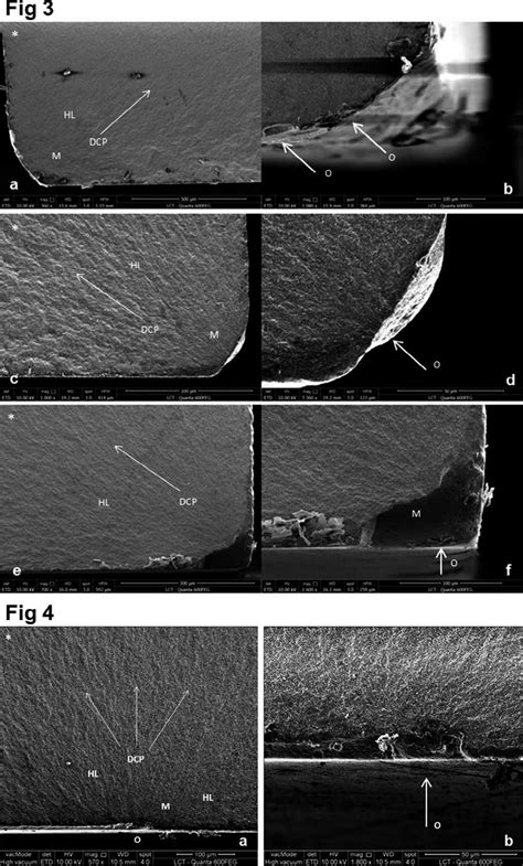 Scanning Electron Micrographs Pr Group A And B Iz Group C And D