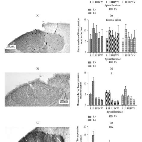 Distribution Of Fos Expression In Laminae I~v Of 3rd 4th And 5th