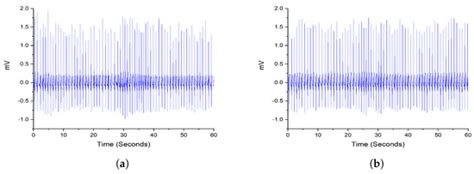 Entropy Free Full Text Sleep Apnea Detection Using Wavelet