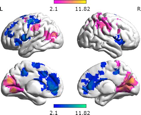 Differential Brain Activation During Navigation In Women And Men Pink